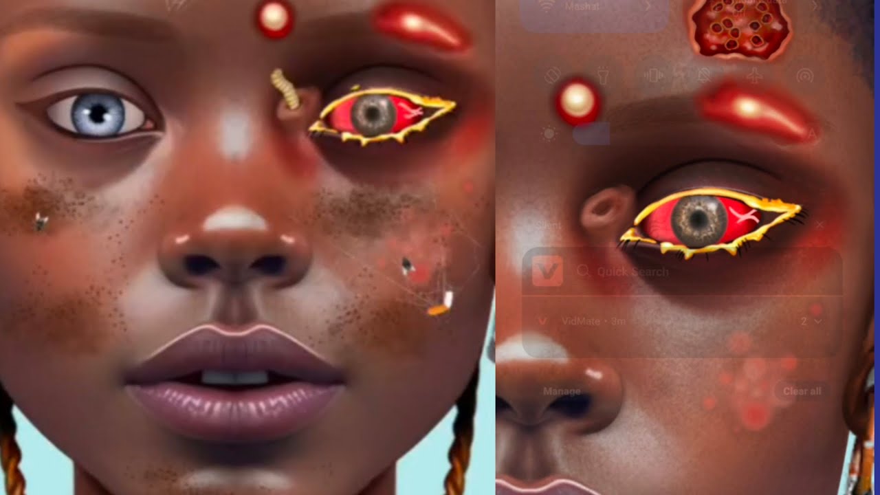 Damage face asmr face Cear #aye Cear # aye mikup #dammagé face - YouTube