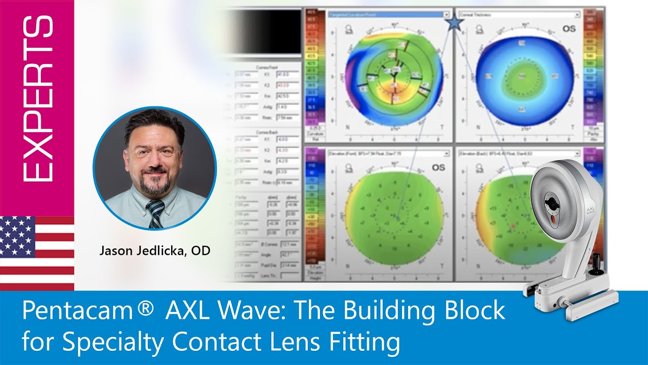 Pentacam® AXL Wave: The Building Block for Specialty Contact Lens ...