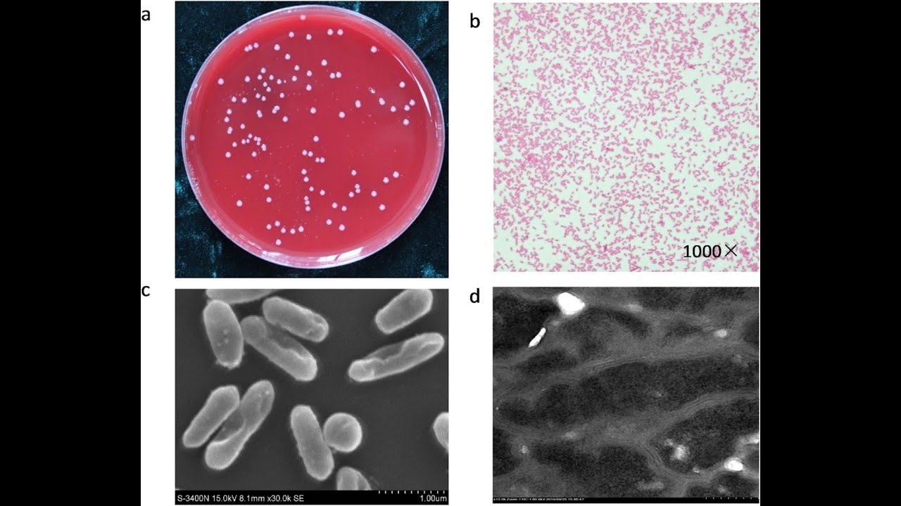 Bacteroides Fragilis ; Definition, Characteristics, Role in Health ...