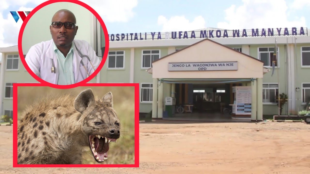MTOTO WA MIAKA 3 AJERUHIWA VIBAYA NA FISI, DAKTARI AELEZA "HALI YAKE NI ...