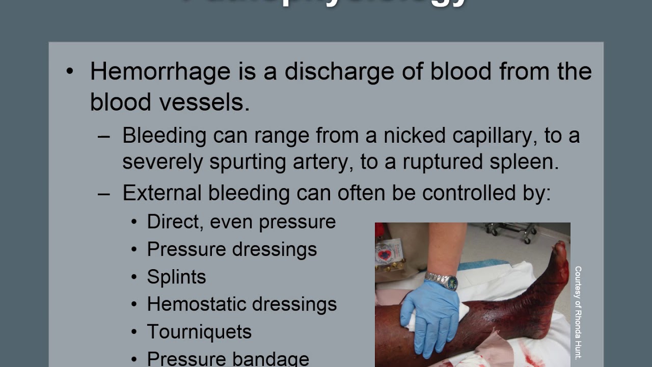 comp chapter 27 Bleeding Recorded Lecture Video - YouTube
