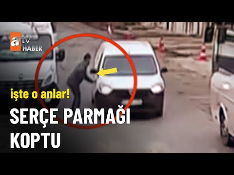 Saniyelik çarpışmada parmağı koptu! - atv Haber 30 Mart 2023