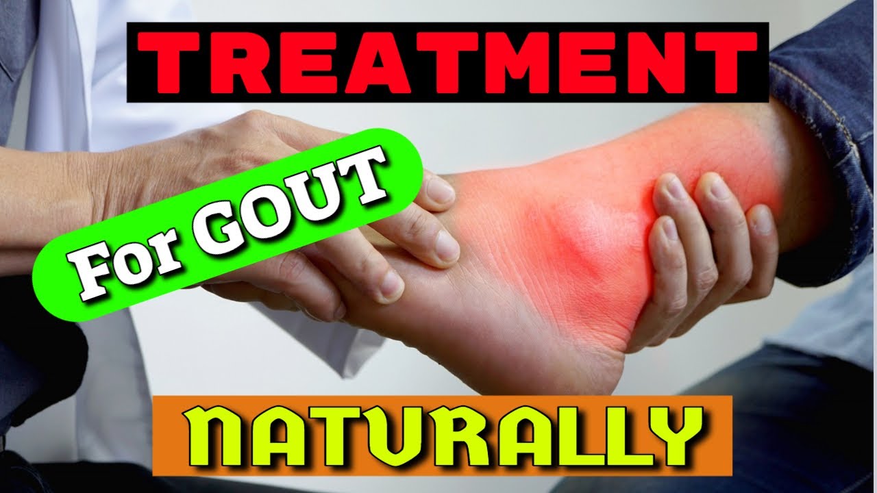 🛑 How to Treat Gout Naturally at Home The Best Treatment for Gout ...