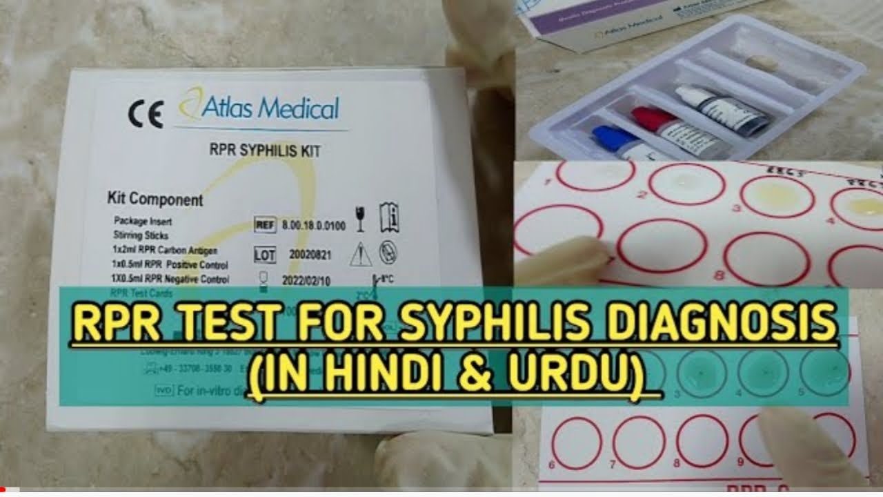How to perform RPR(VDRL) test for syphilis in lab.Practical explained ...