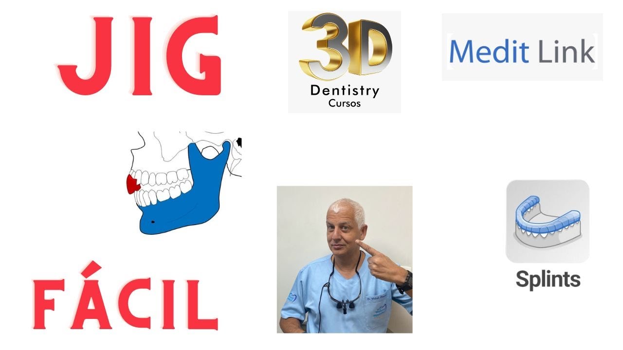 Medit splint JIG de Lucia - YouTube