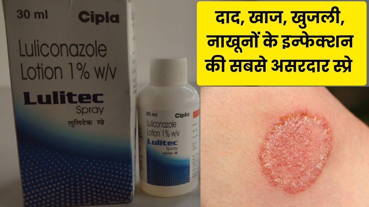Lulitec Spray | Luliconazole spray | दाद, खाज, खुजली और नाखूनों के फंगल ...