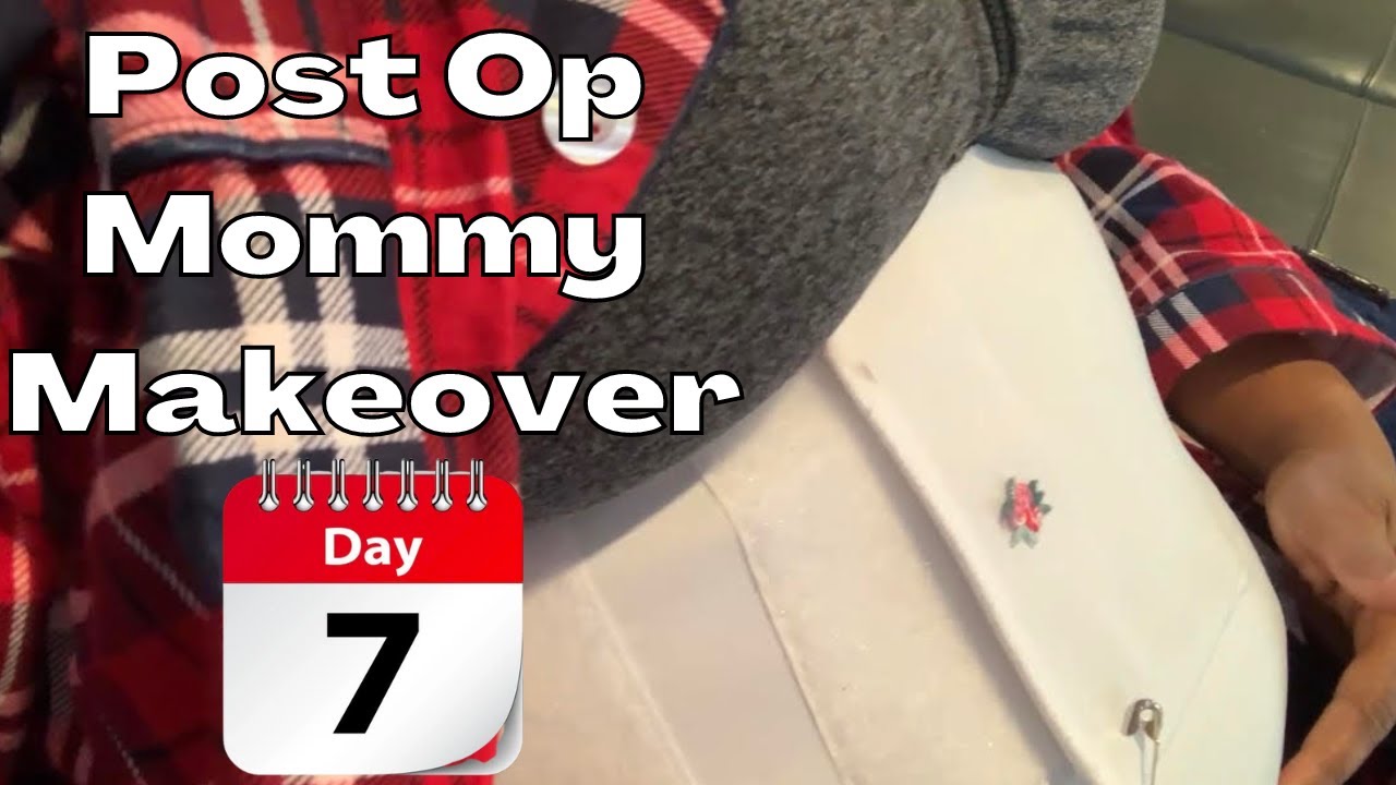 Post Op Mommy Makeover Day 7 Youtube