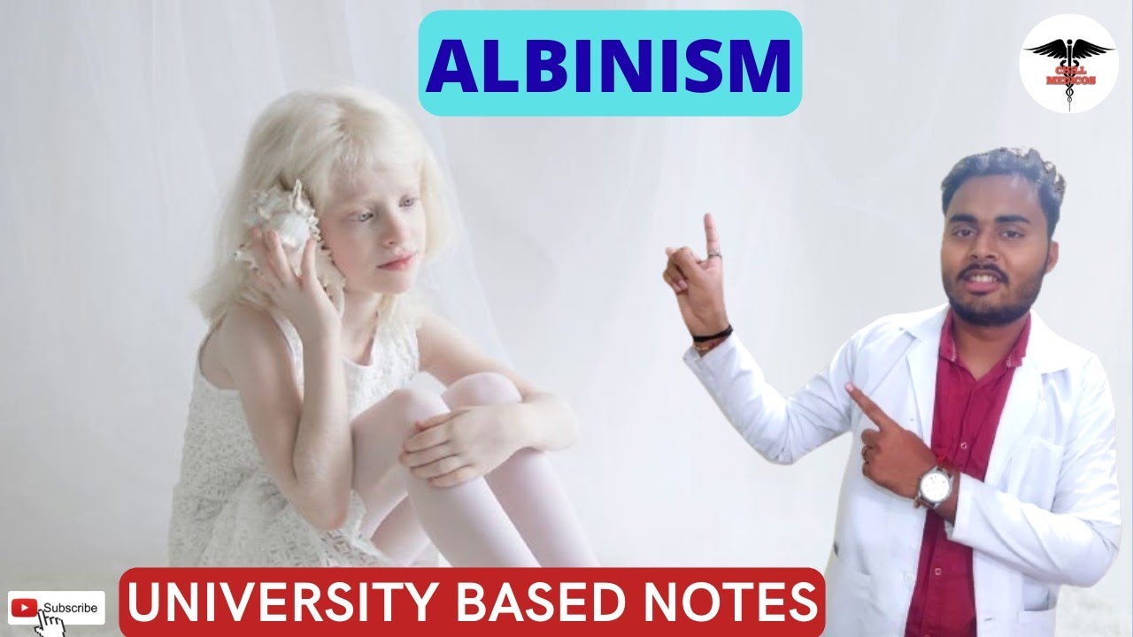 ALBINISM || clinical manifestations | Laboratory findings | treatment ...