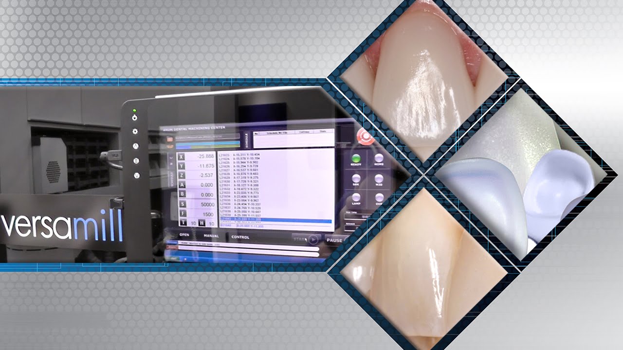 Axsys Dental "inPractice" Digital Dental Solutions - YouTube