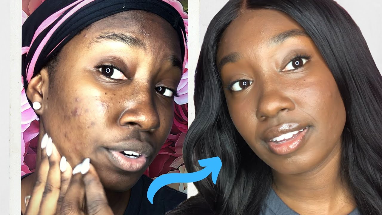 Acne Coverage Makeup Routine - YouTube
