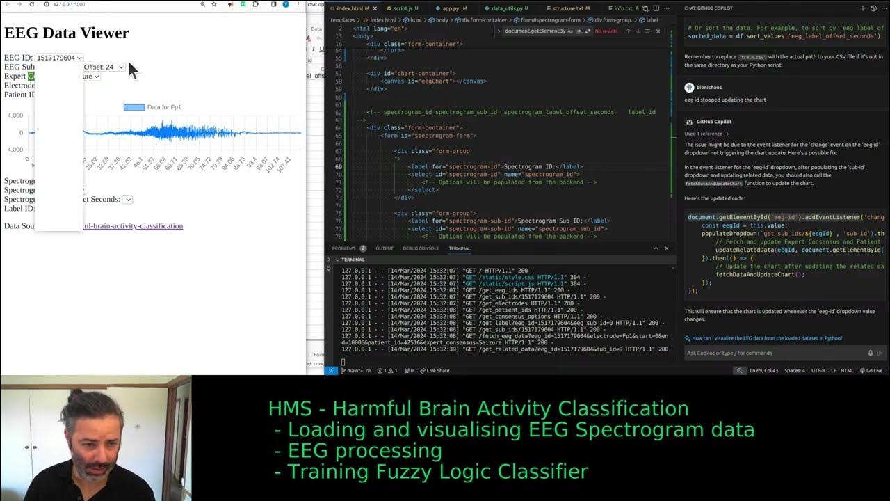 Biomedical Data Tools Live Development: HMS - Harmful Brain Activity Classification - YouTube