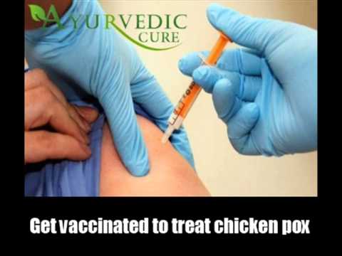 5 Best And Effective Ways To Prevent Chicken Pox - YouTube