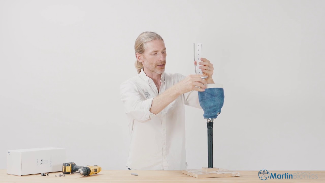 The New Socket less Socket™ cX Hybrid™ | Martin Bionics - YouTube