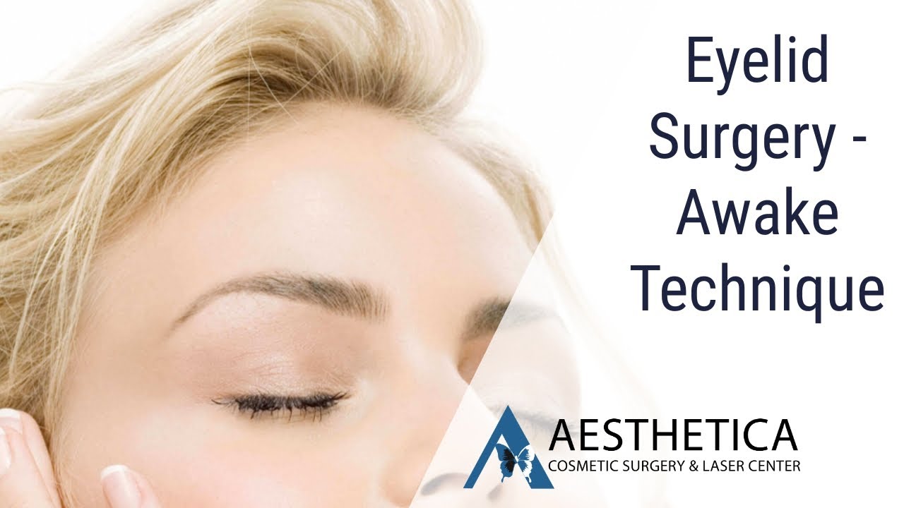 Eyelid Surgery - Awake Technique - Phillip Chang MD www.GoToBeauty.com ...