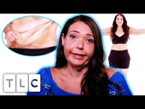 Woman Feels More Ashamed Of Her Body After Weight Loss Surgery | My Extreme Excess Skin