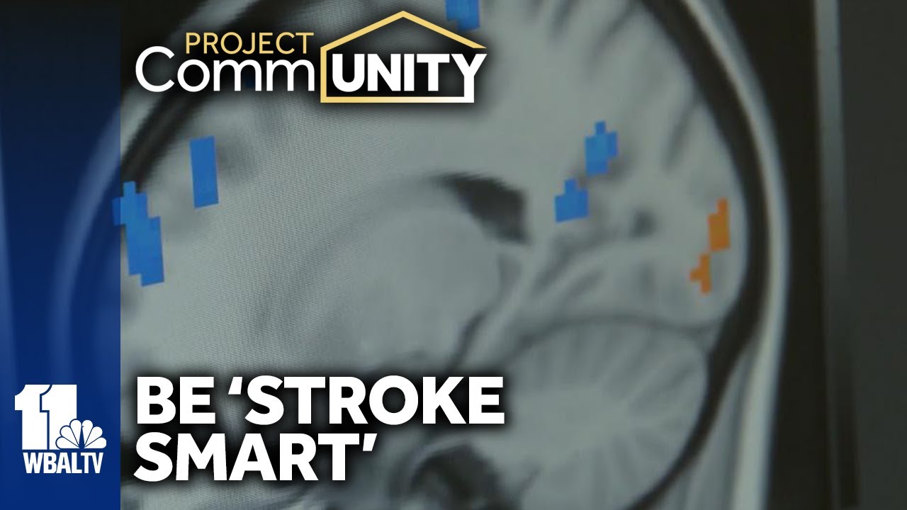 Be 'Stroke Smart': Knowing these symptoms could save a life - YouTube