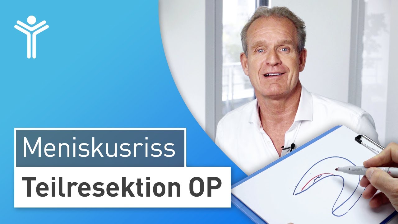 Meniskus OP: Meniskusriss arthroskopisch behandeln | Teilresektion ...