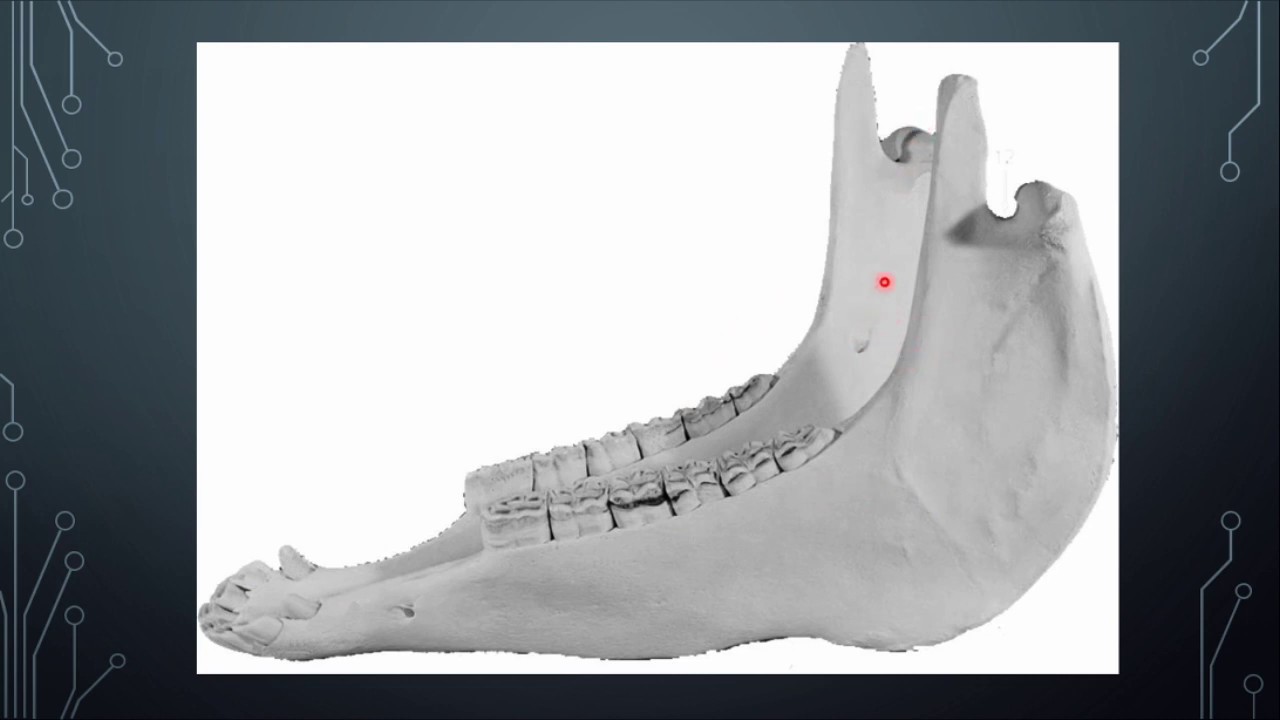 Agujeros de la cabeza - YouTube