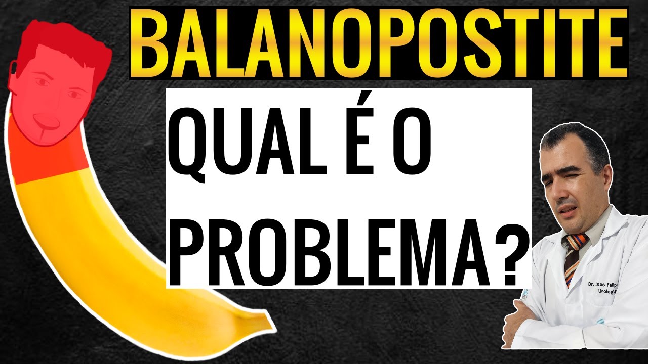 BALANOPOSTITE: o que pode causar esse problema? - YouTube
