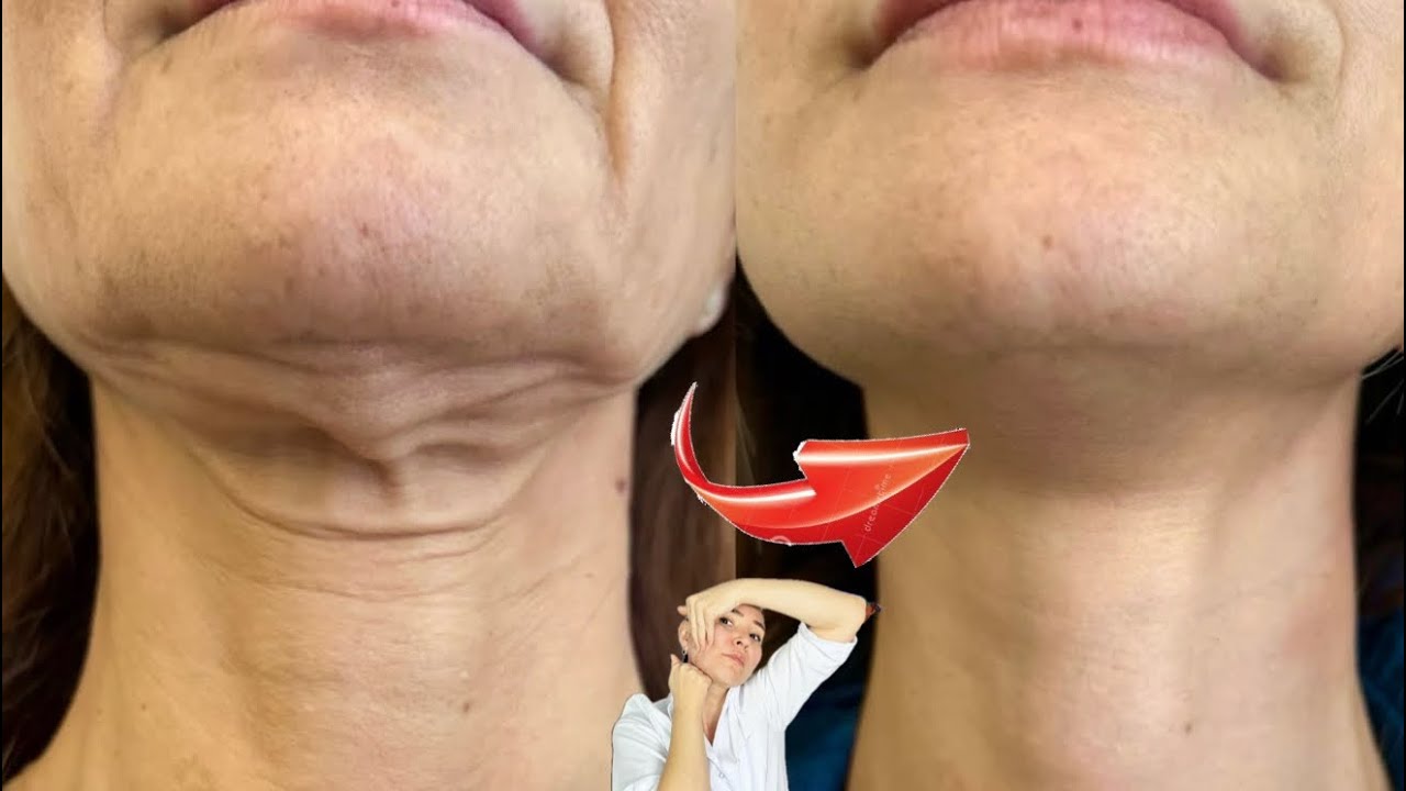 13 Min Massage for SAGGING NECK, TURKEY NECK, WRINKLES ON THE NECK ...