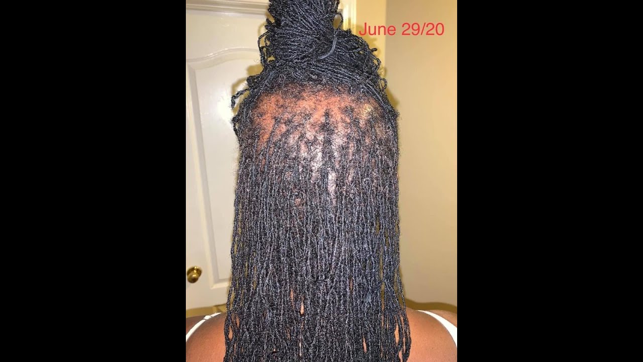 2 MONTH LOC UPDATE! TRACTION ALOPECIA...Starting My Loc journey over ...