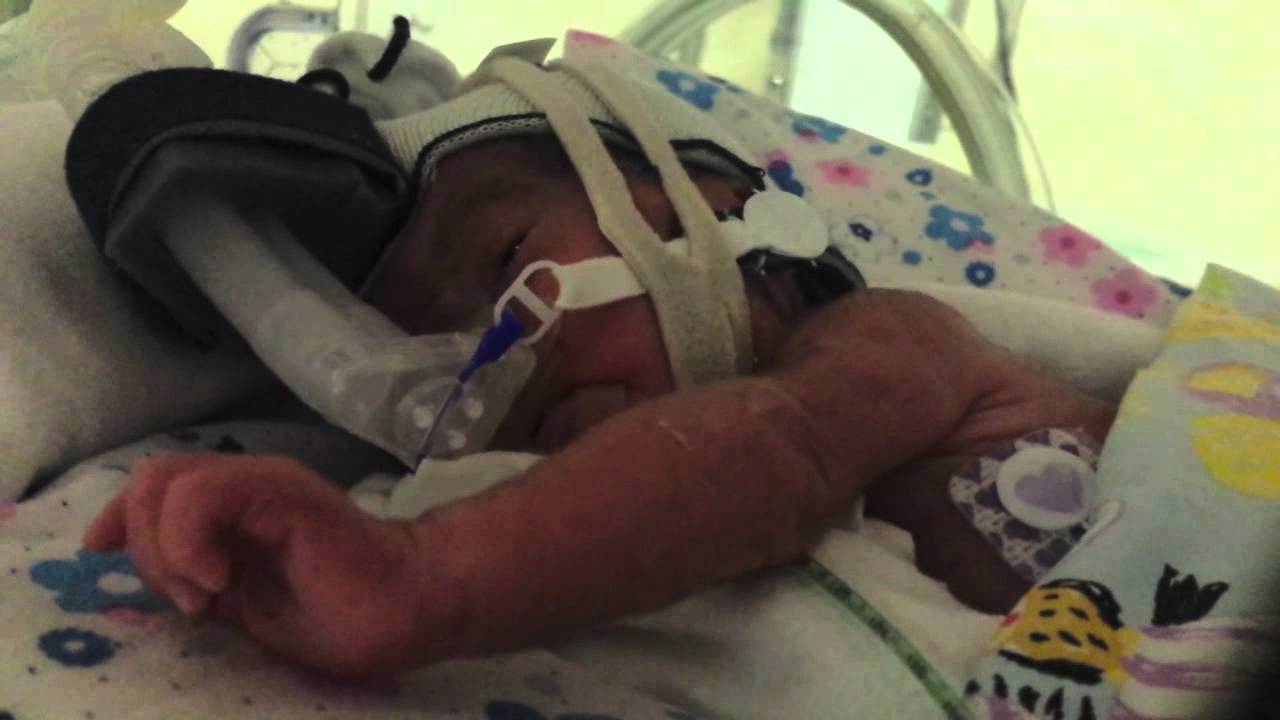 Mila Hope Ponder Born - 27 weeks Gestation - YouTube