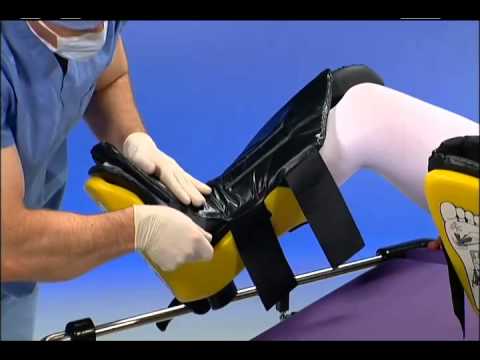 Lithotomy Position In Stirrups