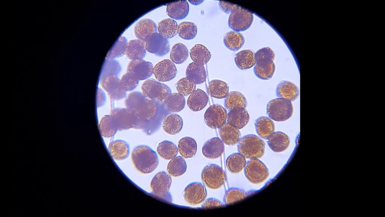 Dinoflagellates (Coolia) and worms - YouTube
