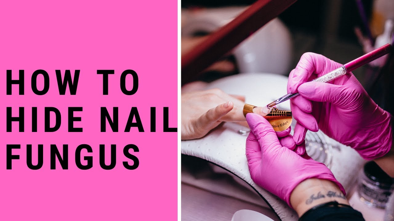 How to Hide Nail Fungus - YouTube