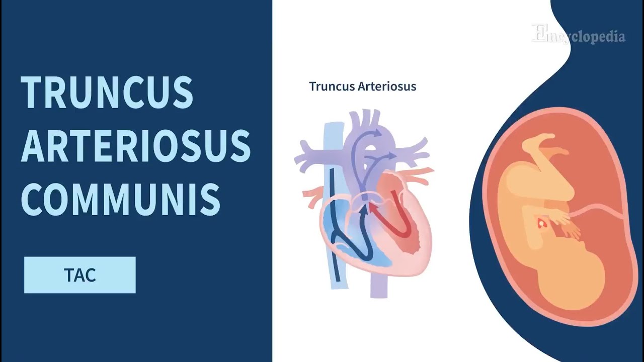 【JCM】Diagnosis, Management, and Outcomes in Fetal Truncus Arteriosus ...