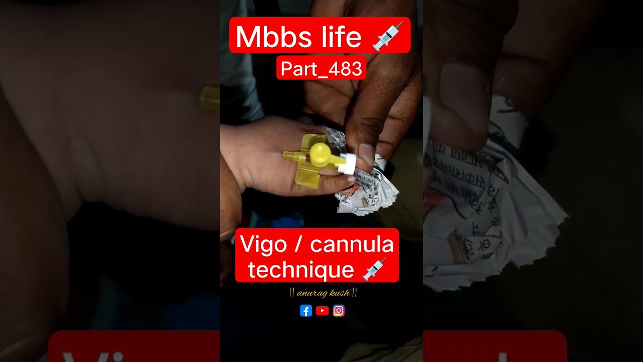 mbbs life 💉 part_483💉Vigo/cannula technique 💉#mbbs #medical #aiims @dr ...