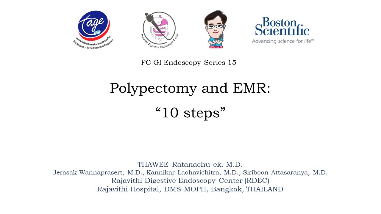 FC GI Series 15 polypectomy and EMR - YouTube