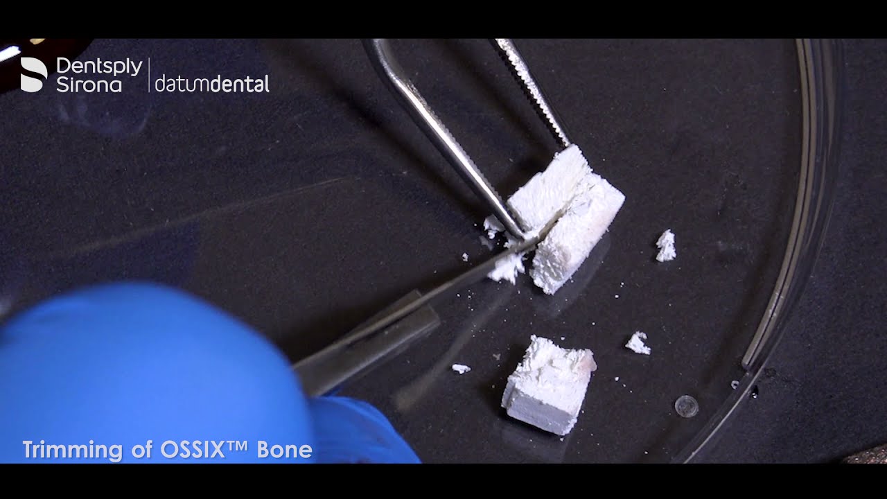 Socket preservation demonstration using OSSIX™ Bone - YouTube
