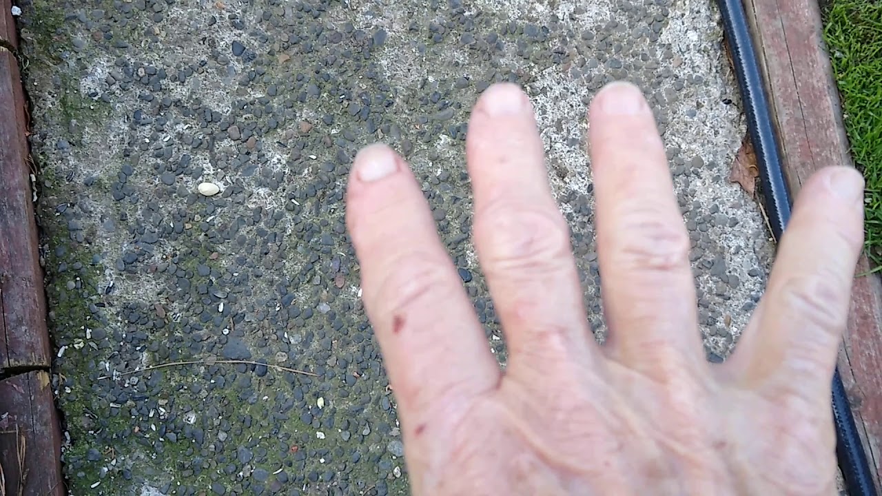 Hard to watch if you might be squeamish. - YouTube