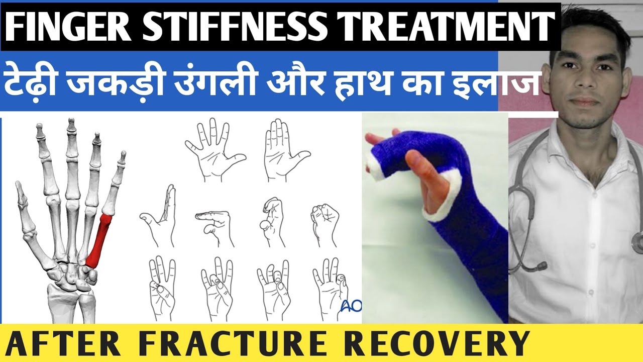 hand and finger exercises to perform to decrease stiffness ||Tedi ungli ko sidha kaise karen ...
