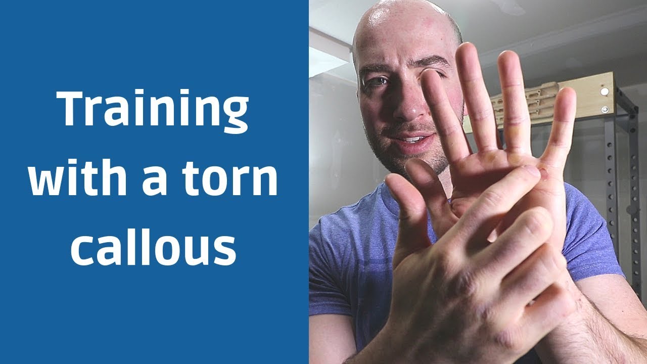 TRAINING WITH A TORN CALLOUS | TRAINING VLOG 009 - YouTube