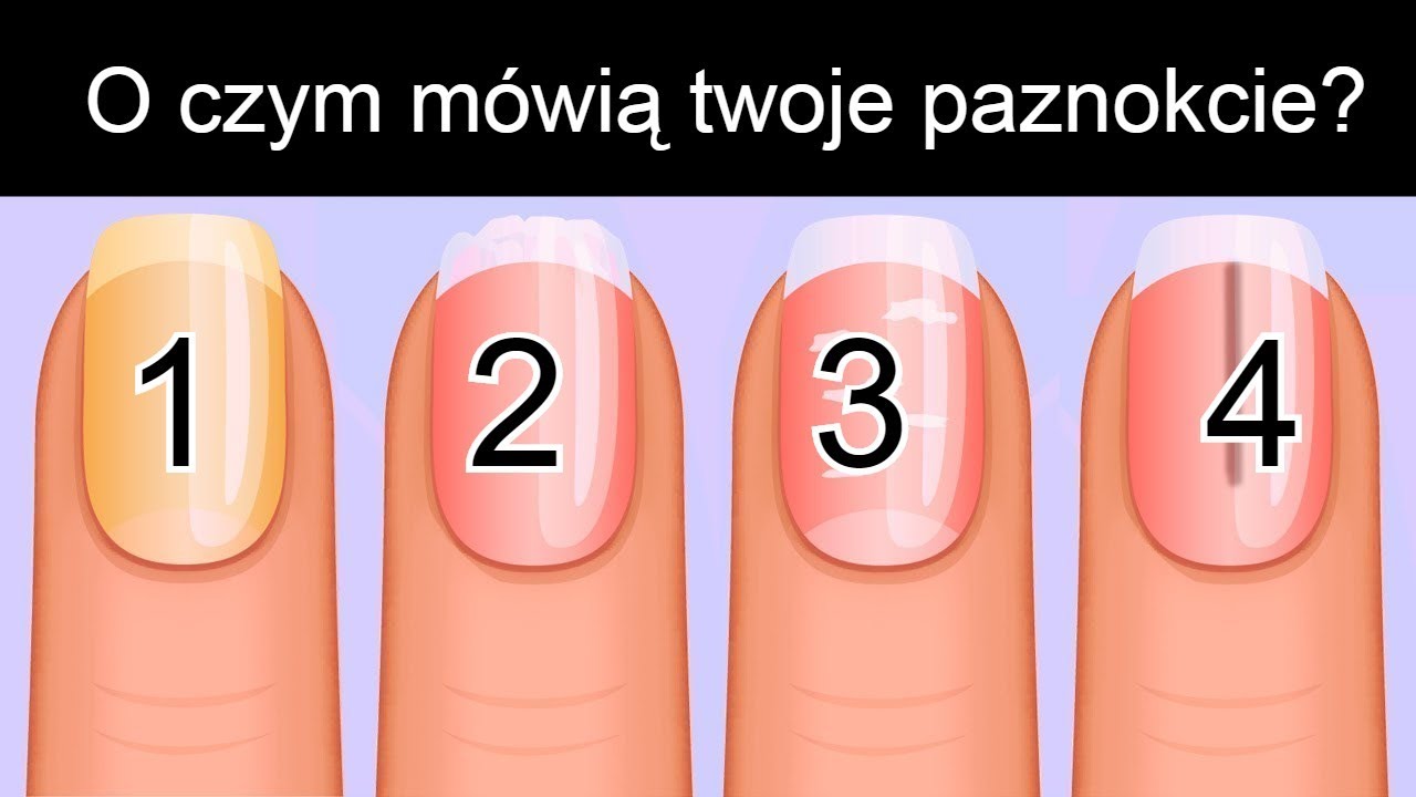 Co Paznokcie M wi O Twoim Zdrowiu YouTube co-paznokcie-m-wi-o-twoim-zdrowiu-youtube