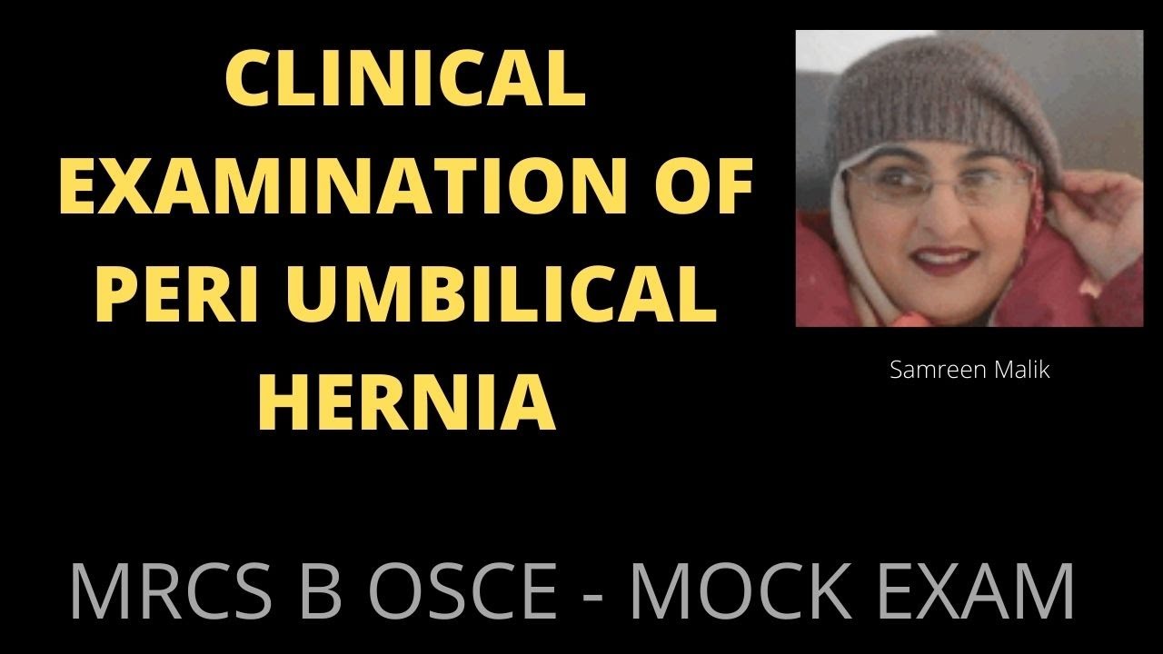 CLINICAL EXAMINATION OF PERI UMBILICAL HERNIA - YouTube