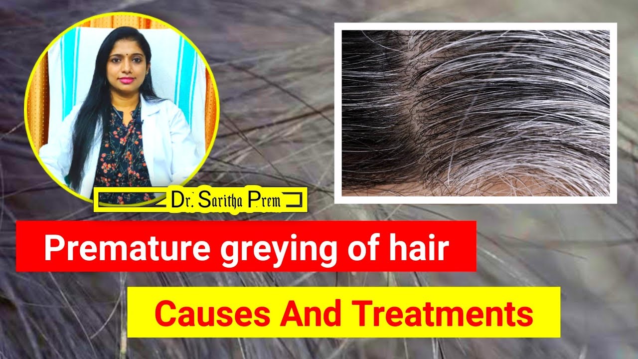 Premature Greying of hair, causes and treatments / Dr. Saritha Prem ...