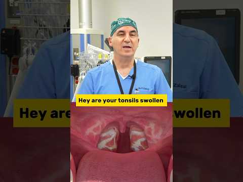 What Kind Of Doctor Should I See For Tonsillitis