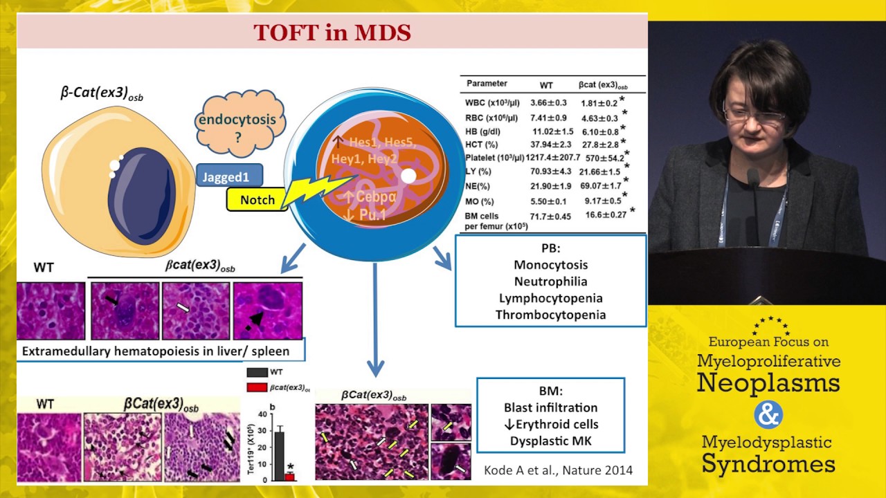 Advances in understanding of MDS microenvironment - YouTube