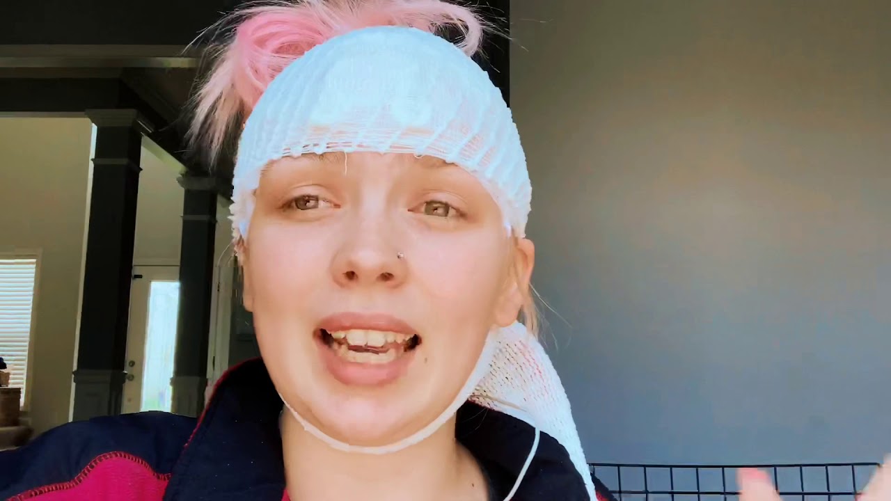 72 hr EEG - YouTube