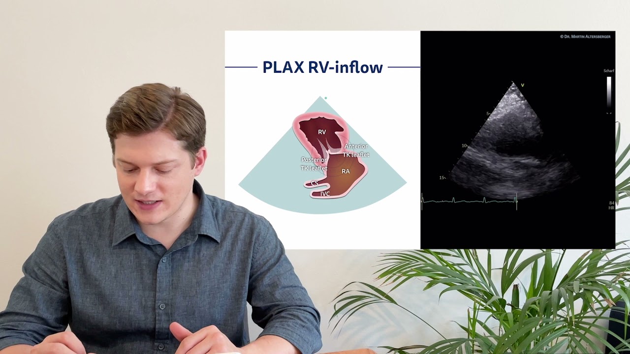 〖Echocardiography〗 Parasternal Long Axis View (PLAX) part 3 - atypical ...