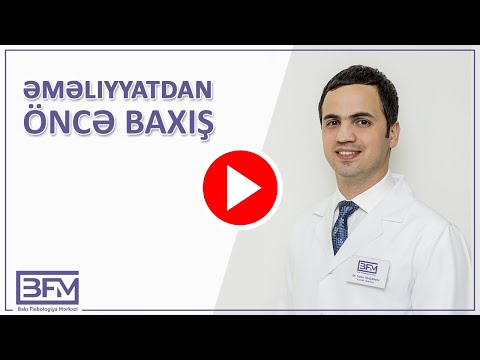 Endovenoz Lazer Əməliyyatıdan öncə baxış - Dr. Samir Abdullayev