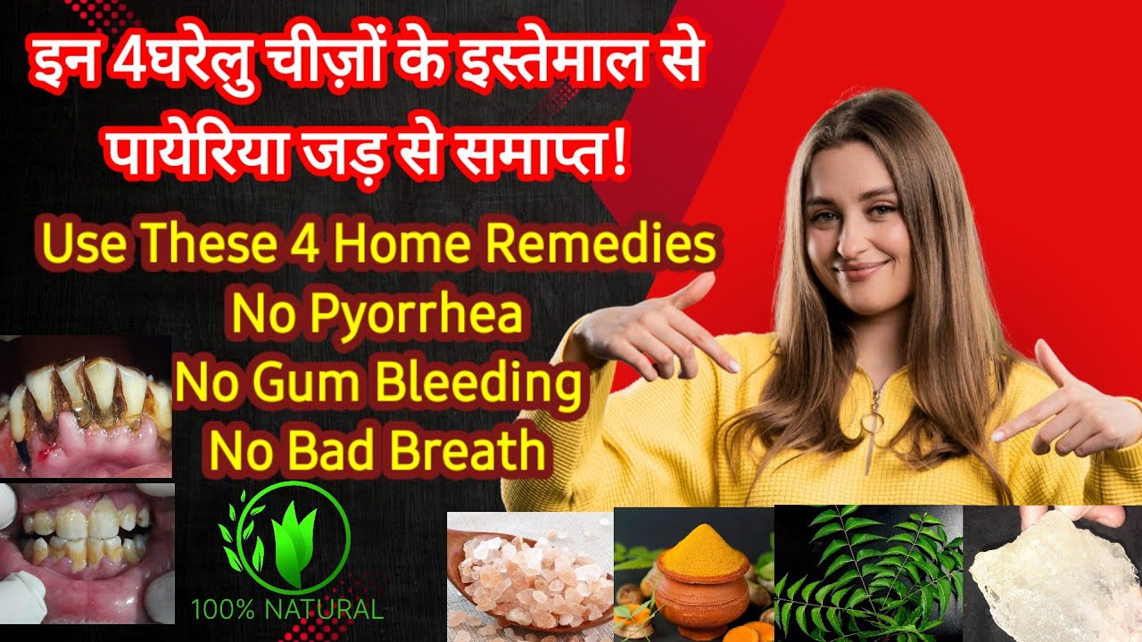 pyorrhea ka gharelu ilaj!Pyorrhea Treatment at home!Gingivitis ...