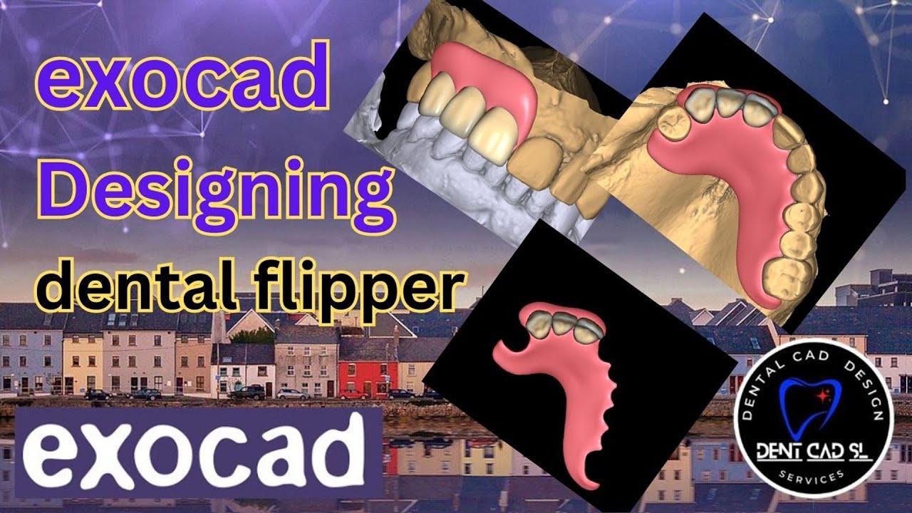 ExoCad dental flipper design - YouTube