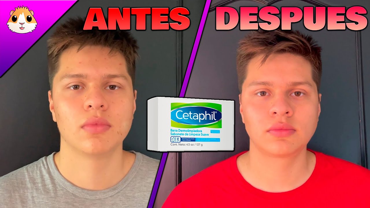 Probé durante 7 días este jabón para el acné!!! (Cetaphil) | Funciona ...