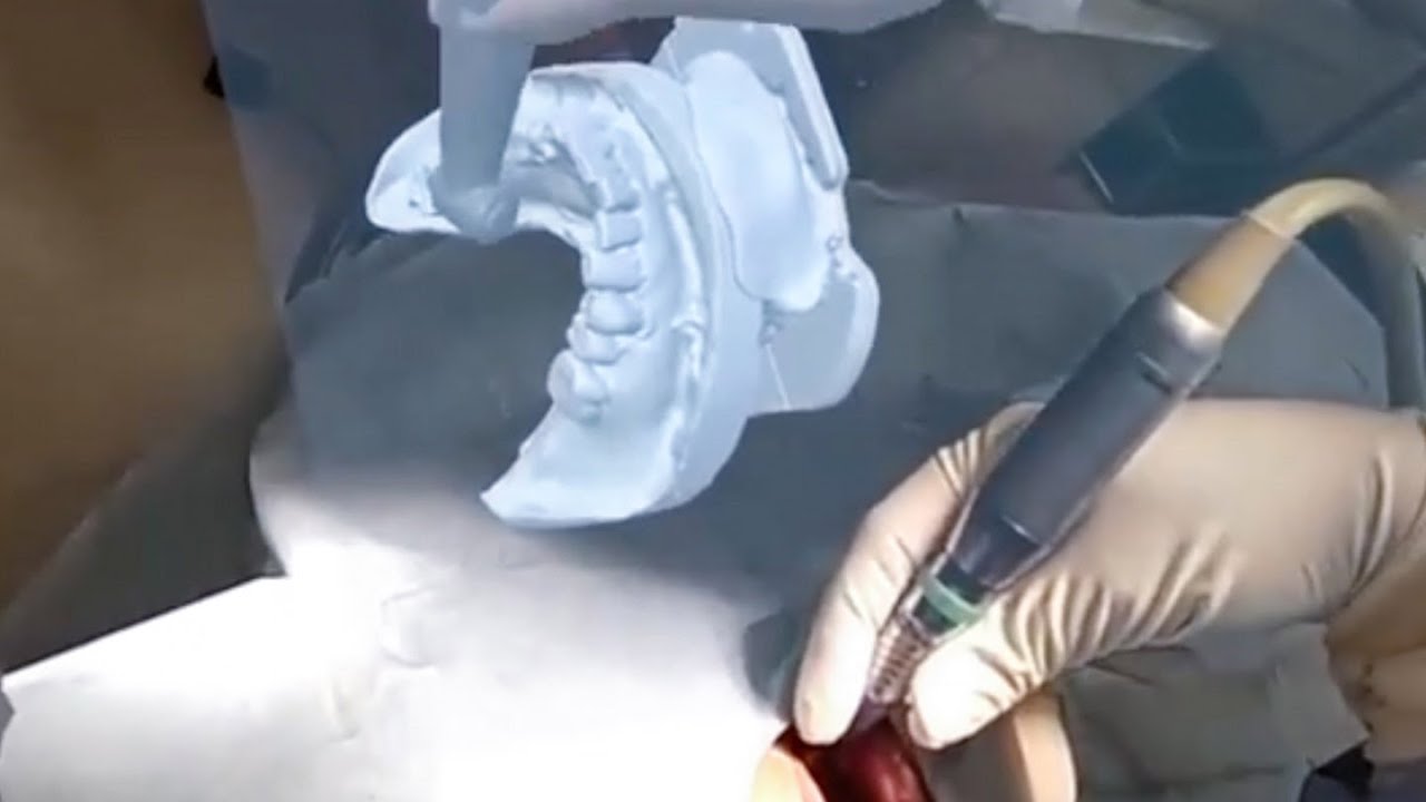 Video 2: Dental implant surgery using MR devices. Video seen by the ...