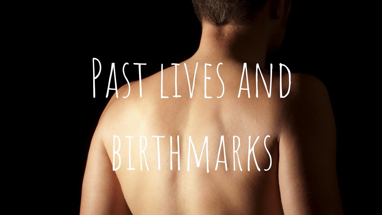 Past Lives and Birthmarks! - YouTube