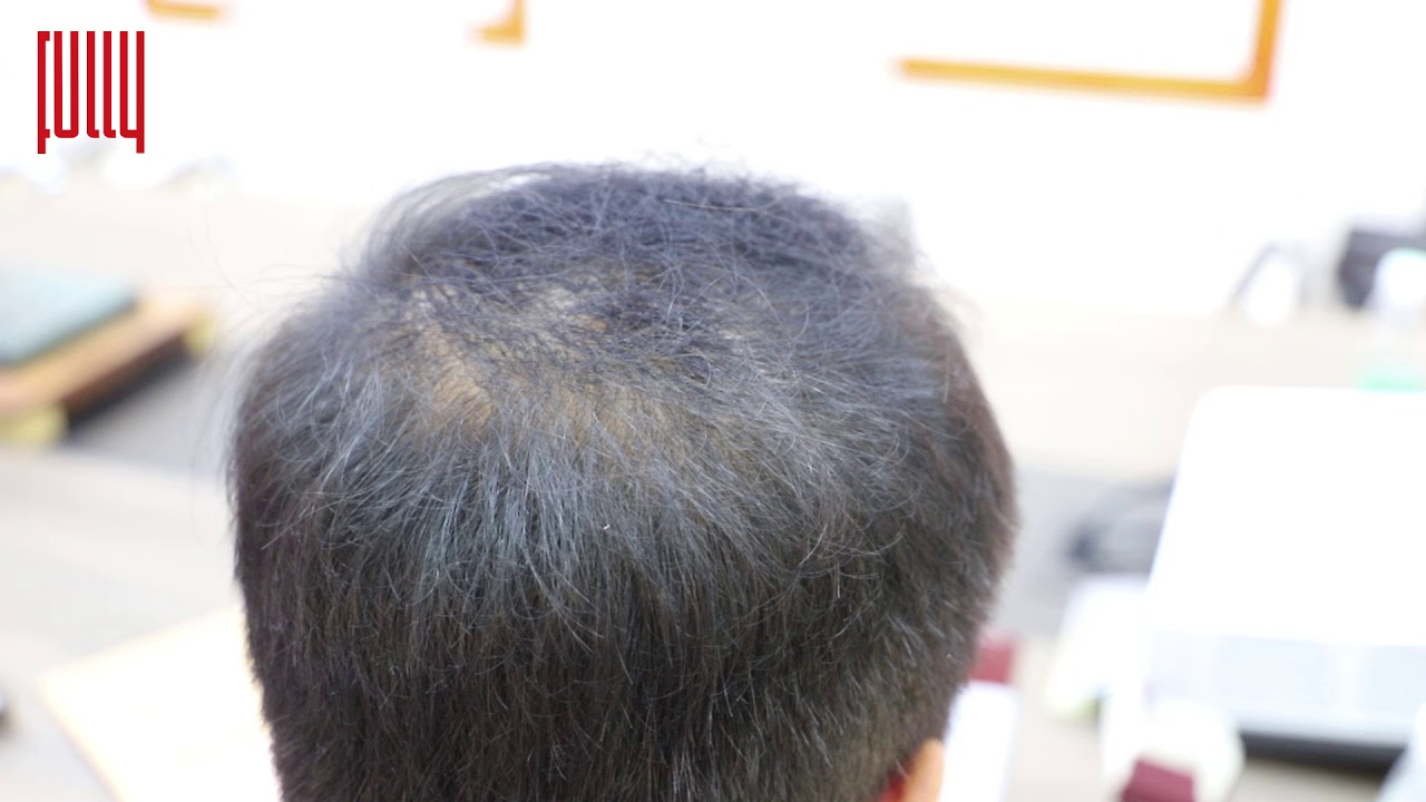 hair building fiber FULLY Hair Fiber Rs.999/- toppik hair building ...